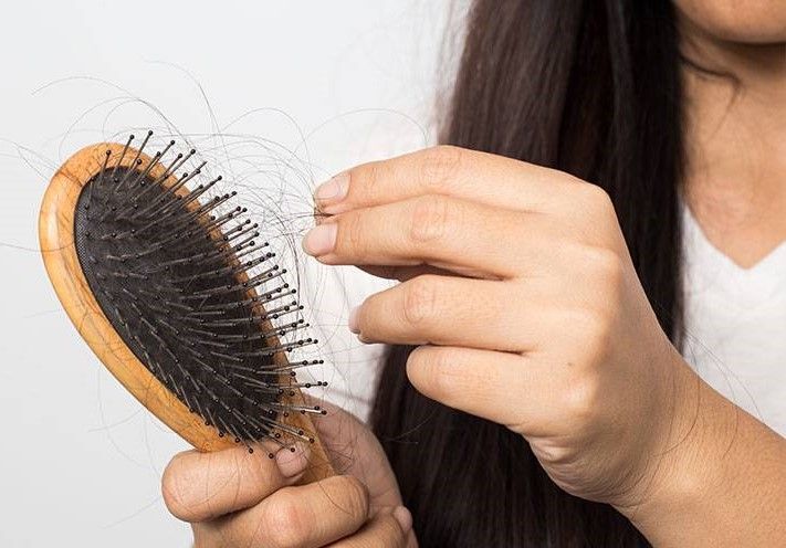 Rambut Gugur Banyak, Ini Sebab dan Cara Mengatasi