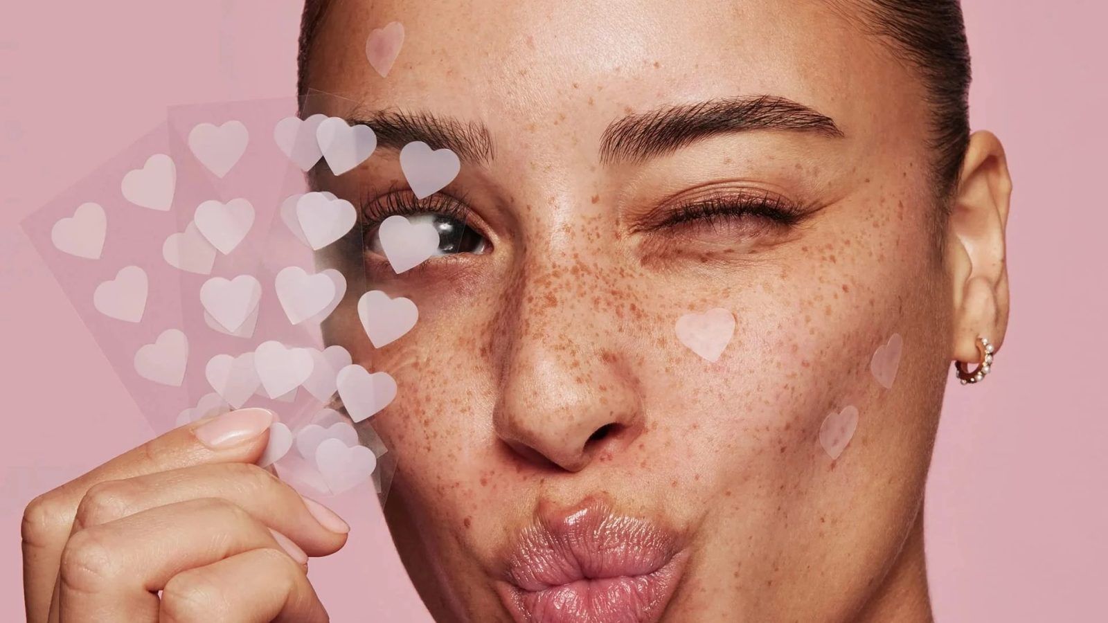 Acne patch bantu atasi masalah jerawat sekaligus naikkan keyakinan diri