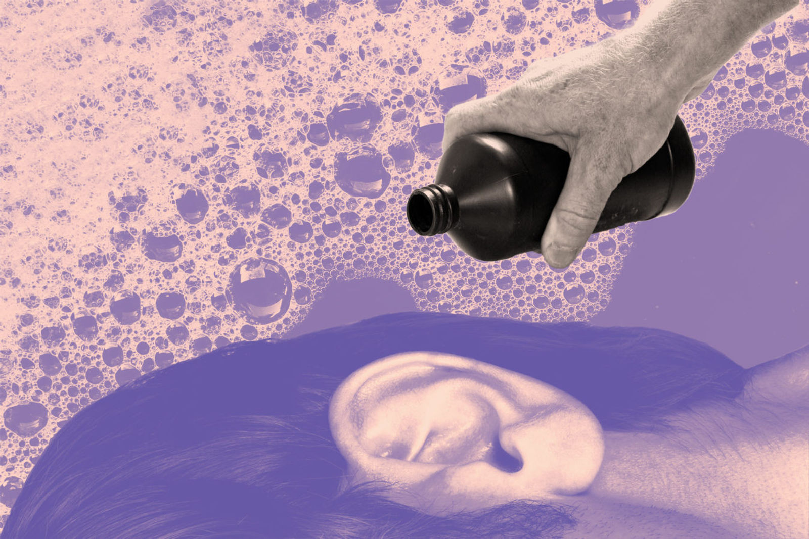 Can you safely use hydrogen peroxide to remove ear wax?