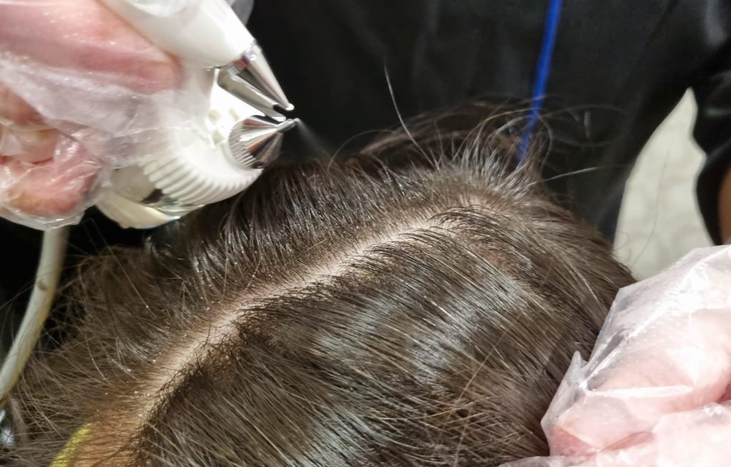 Review: TK TrichoKare’s scalp treatment is the secret to beating hair ...