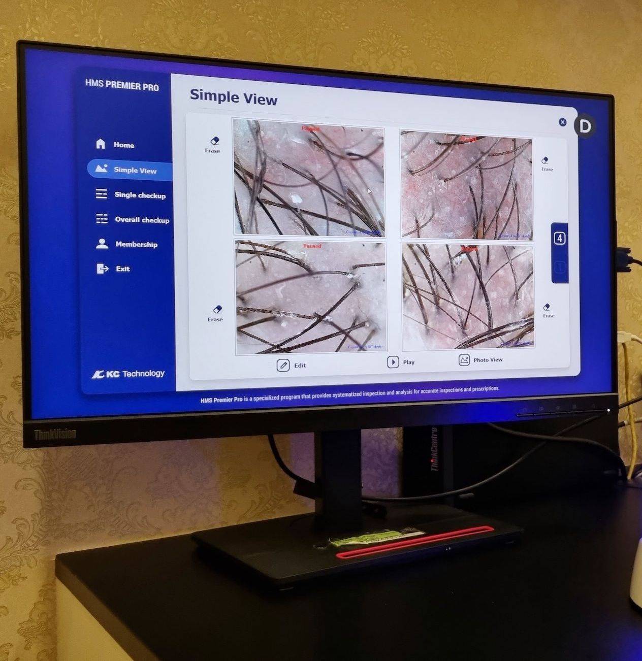 Review: TK TrichoKare’s scalp treatment is the secret to beating hair ...