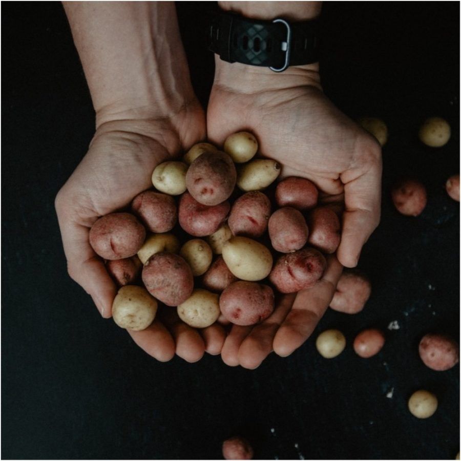 7 DIY remedies you can try at home to get rid of stretch marks