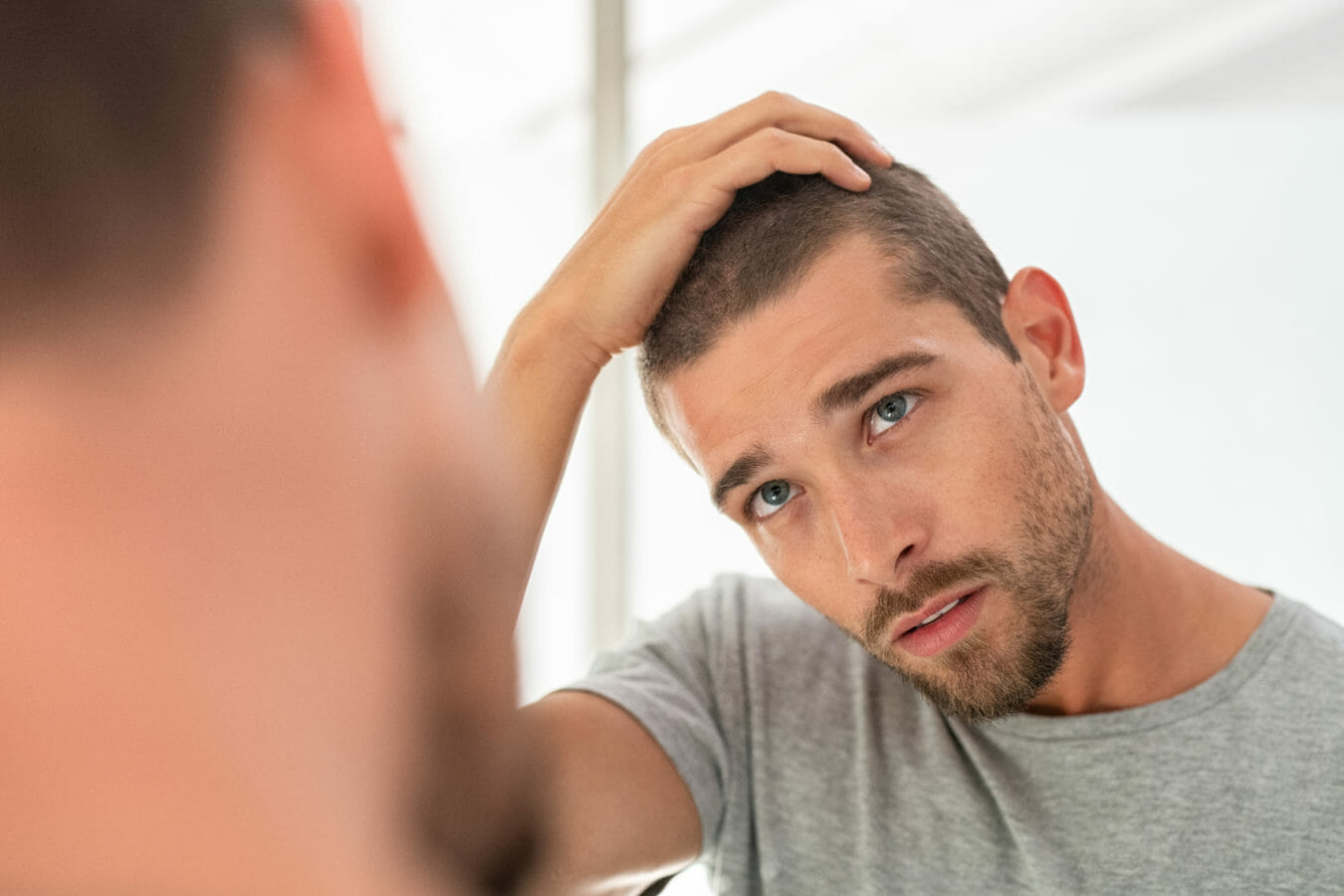 Expert's guide: How to identify early signs of balding and counter them