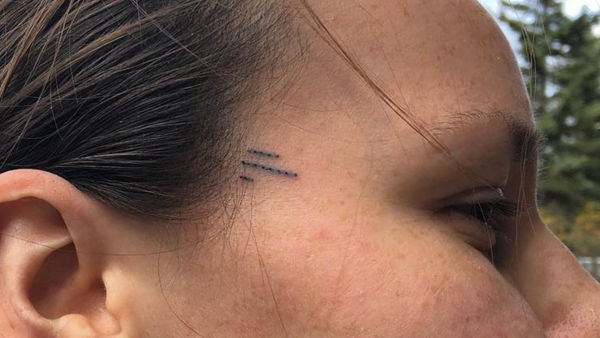 The resurgence of the ancient art of skin-stitch tattoos