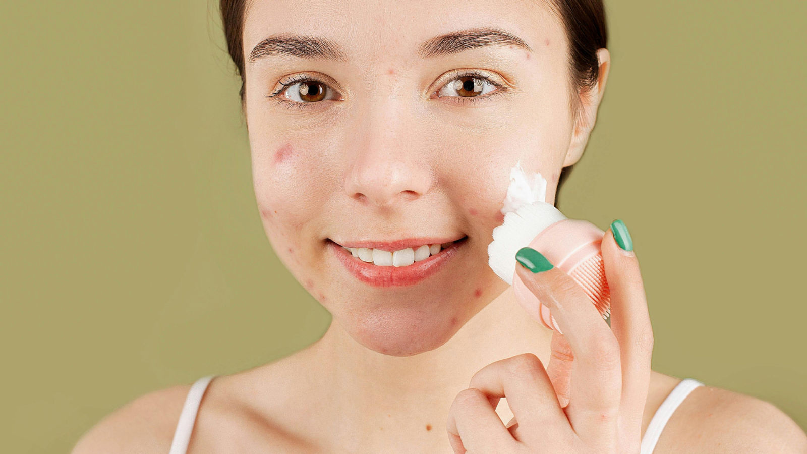 How to get rid of pimple marks? Follow these 4 effective methods